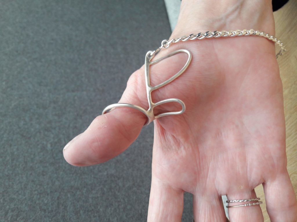 Positive Points of Hand Splints - Positive Positioning
